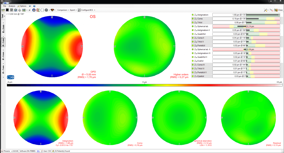 CSO MS39 - Cornea Medical
