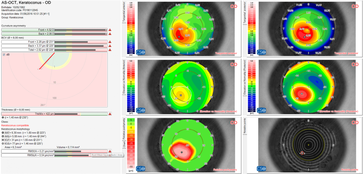 CSO MS39 - Cornea Medical